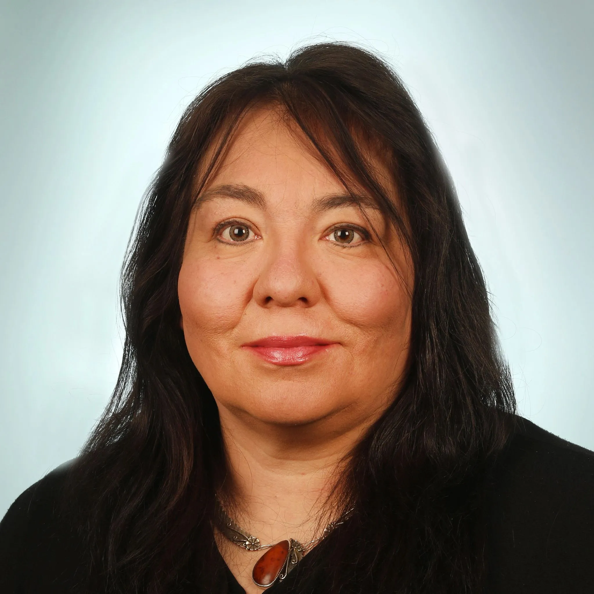 Dr. Ysela Carrillo, MD | Colorado Springs, CO | General Surgery
